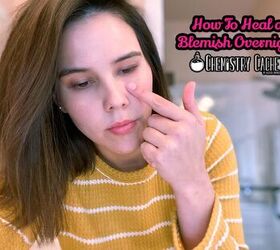 How To Heal A Blemish Overnight | Upstyle