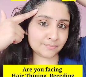 How ONIONS and GINGER Can Help Your Receding Hair | Upstyle